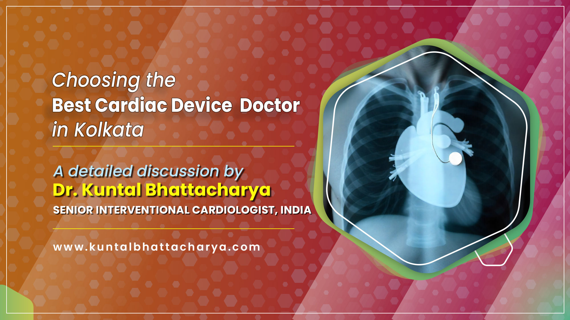 Choosing the Best Cardiac Device Doctor in Kolkata in 2025